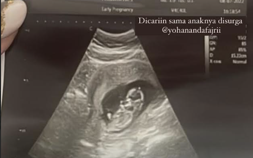 Diduga Paksa Pacar Aborsi, Oknum Polisi di Aceh Diperiksa